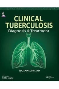 Clinical Tuberculosis Diagnosis & Treatment - Bookbuzzz